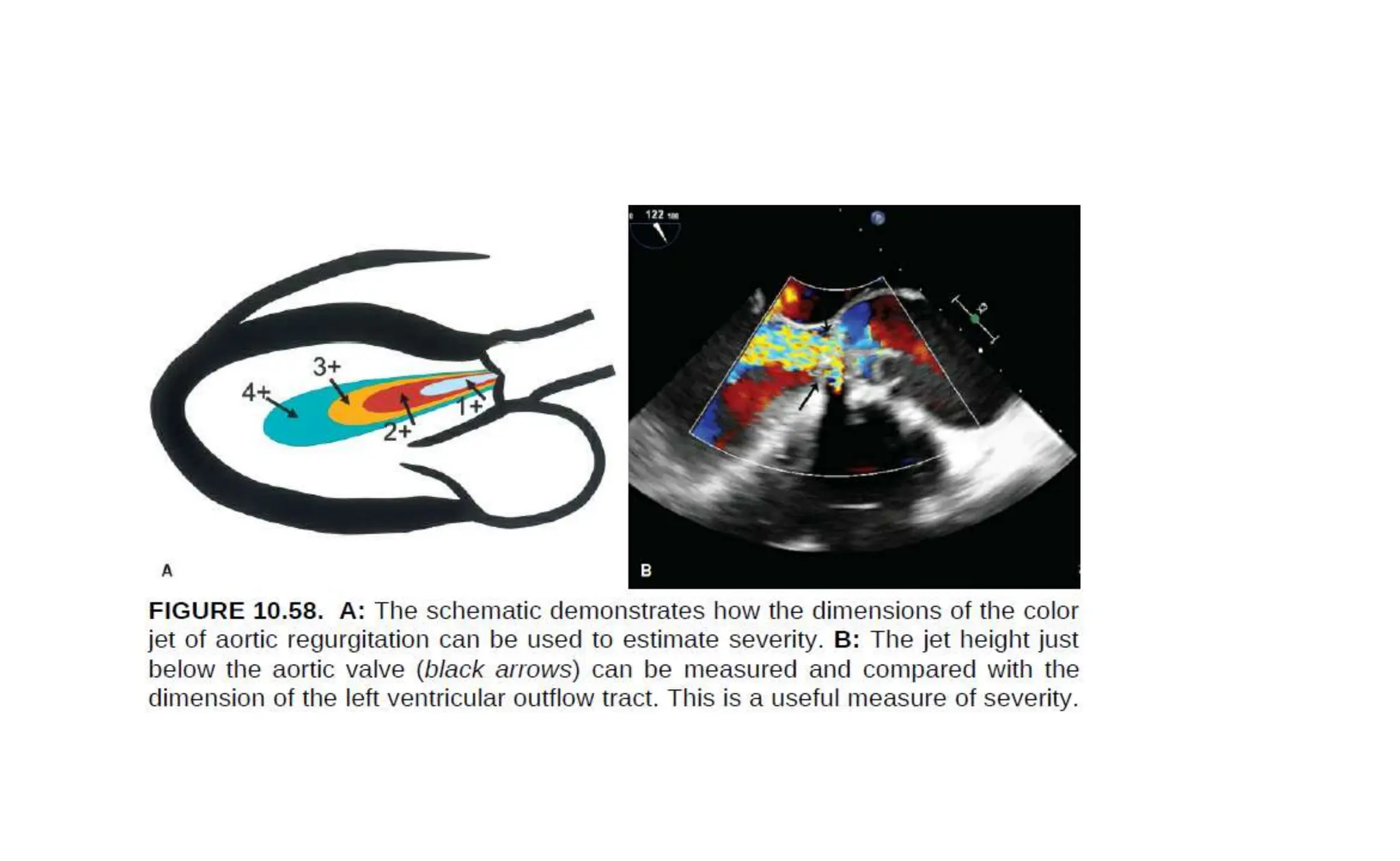 Valvular heart disease.pptx | Heart and Cardiovascular Diseases ...
