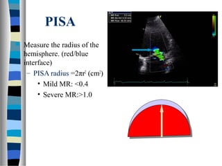 Valvular heart disease assessment of lesion severity | PPT