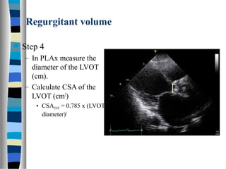 Valvular heart disease assessment of lesion severity | PPT