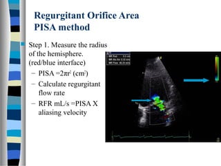 Valvular heart disease assessment of lesion severity | PPT
