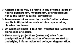 Valvular heart diseases 4 | PPTX
