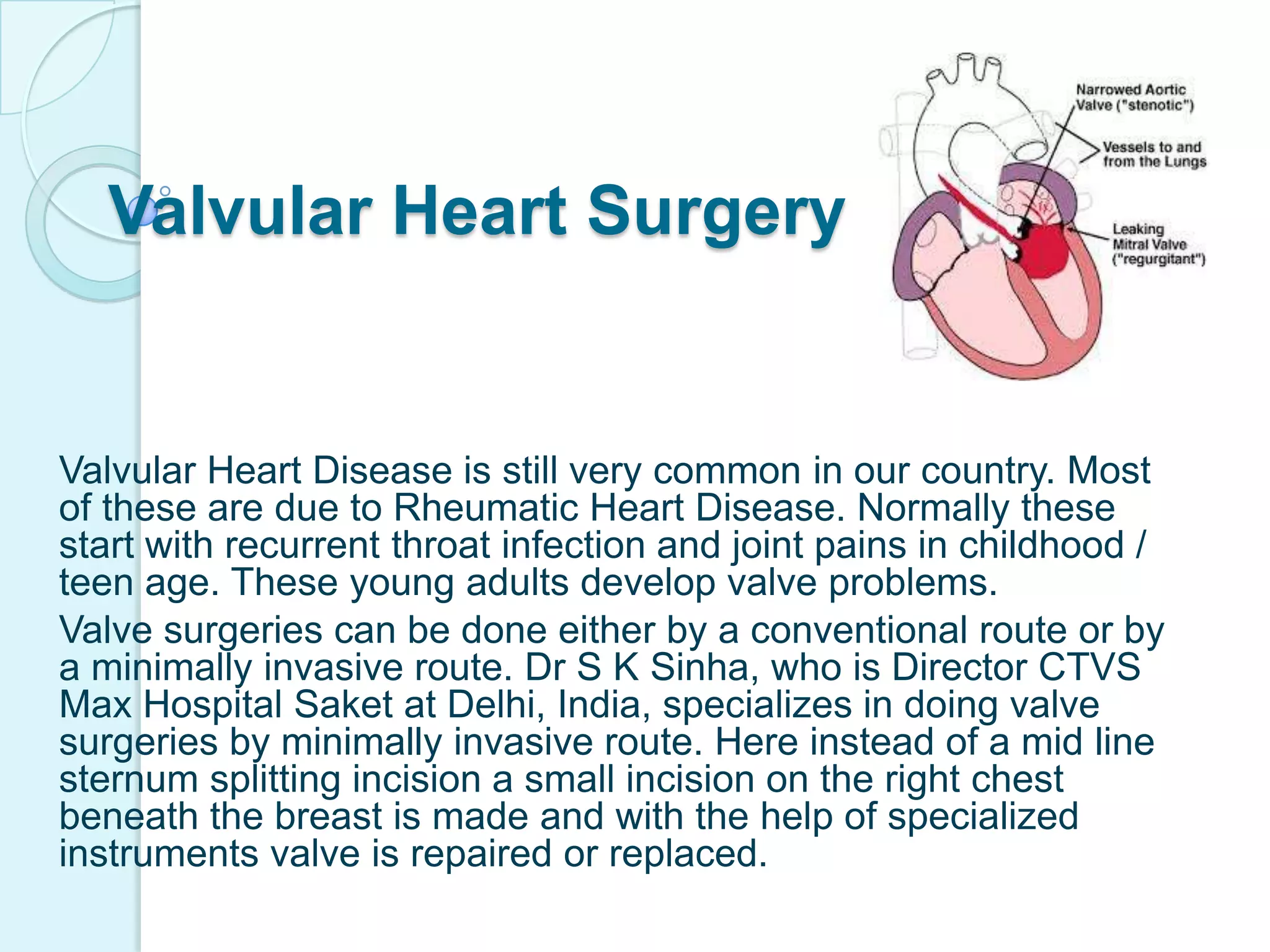 Valvular heart surgery | PPTX