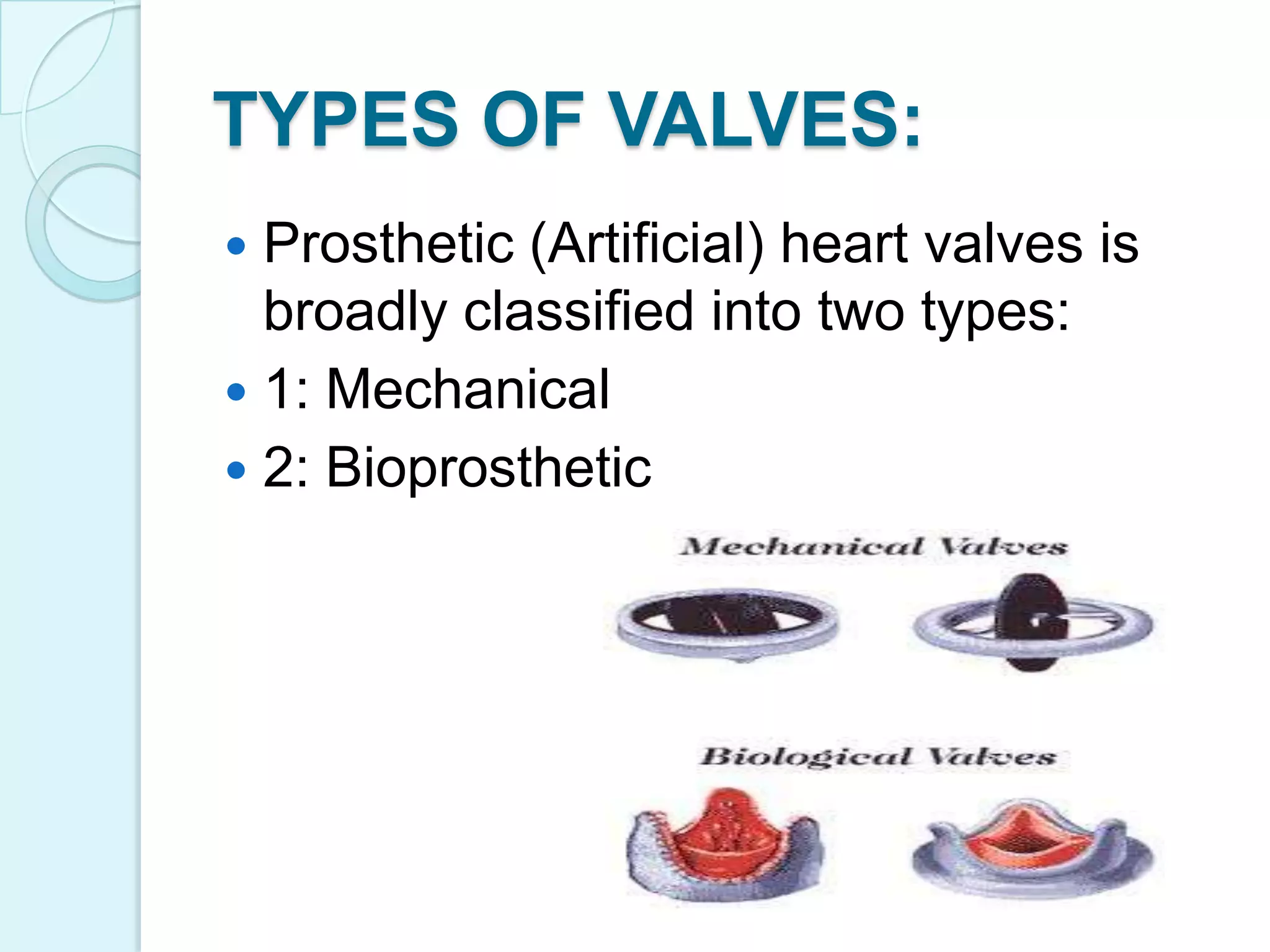 Valvular heart surgery | PPTX