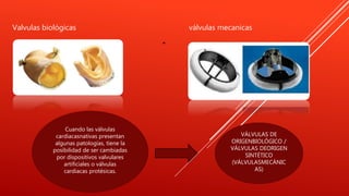 Valvulas | PPTX