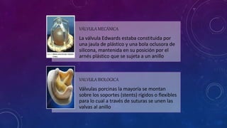 Valvulas cardiacas | PPTX