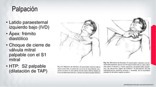 VALVULOPATÍA INSUFICIENCIA ESTENOSIS MITRAL AA-.pptx