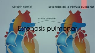 Comprehensive Overview of Valvular Heart Diseases: Diagnosis and ...