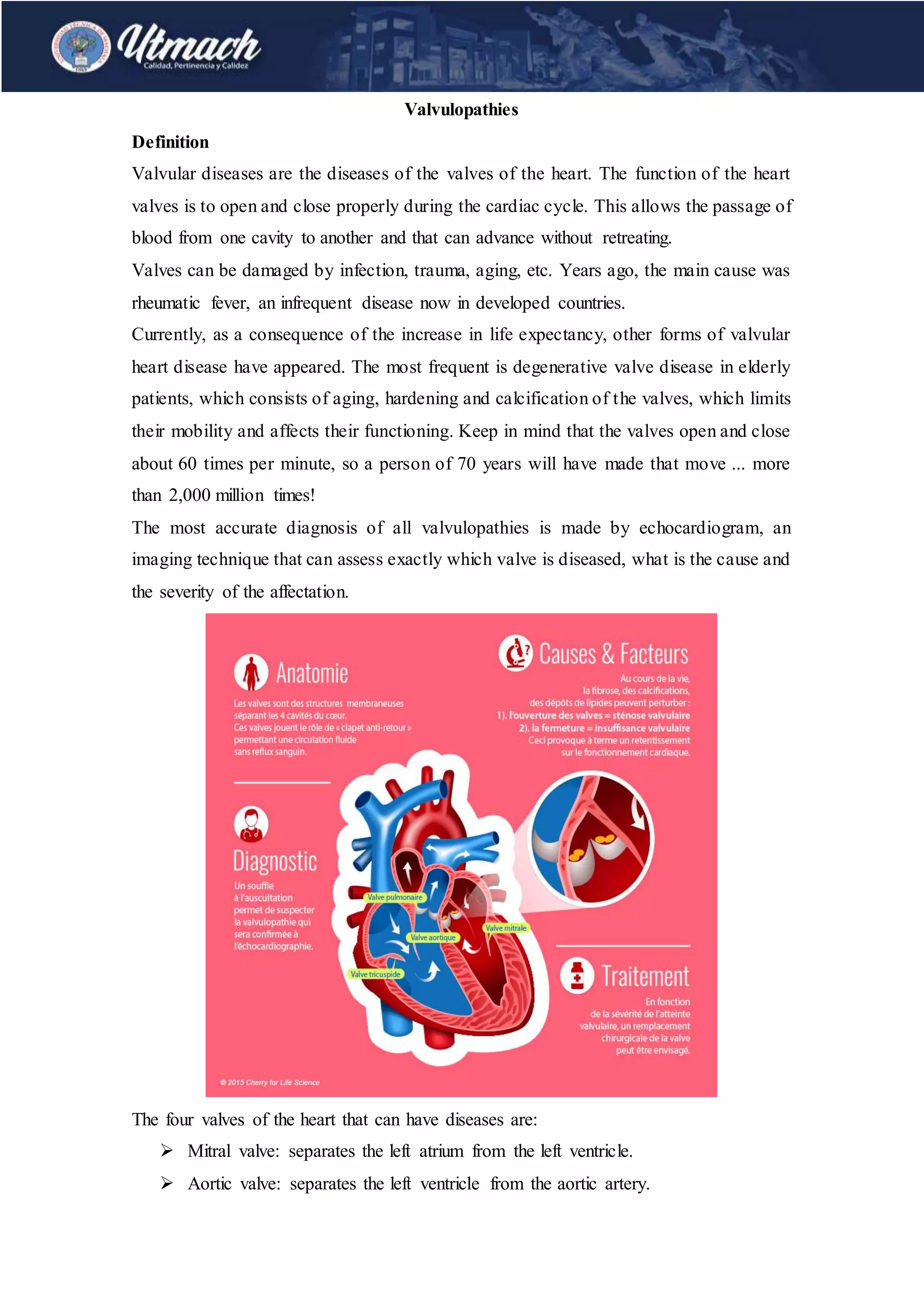 Valvulopathies n | DOCX