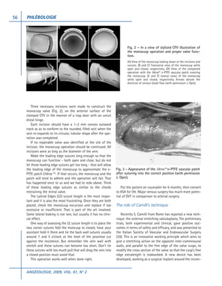 Valvuloplastie | PDF
