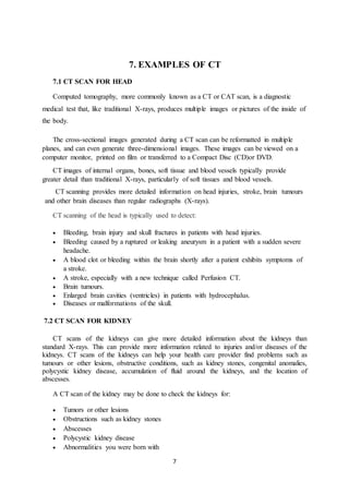 COMPUTED TOMOGRAPHY | DOCX