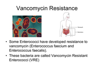 TDM Vancomycin pdf | PDF