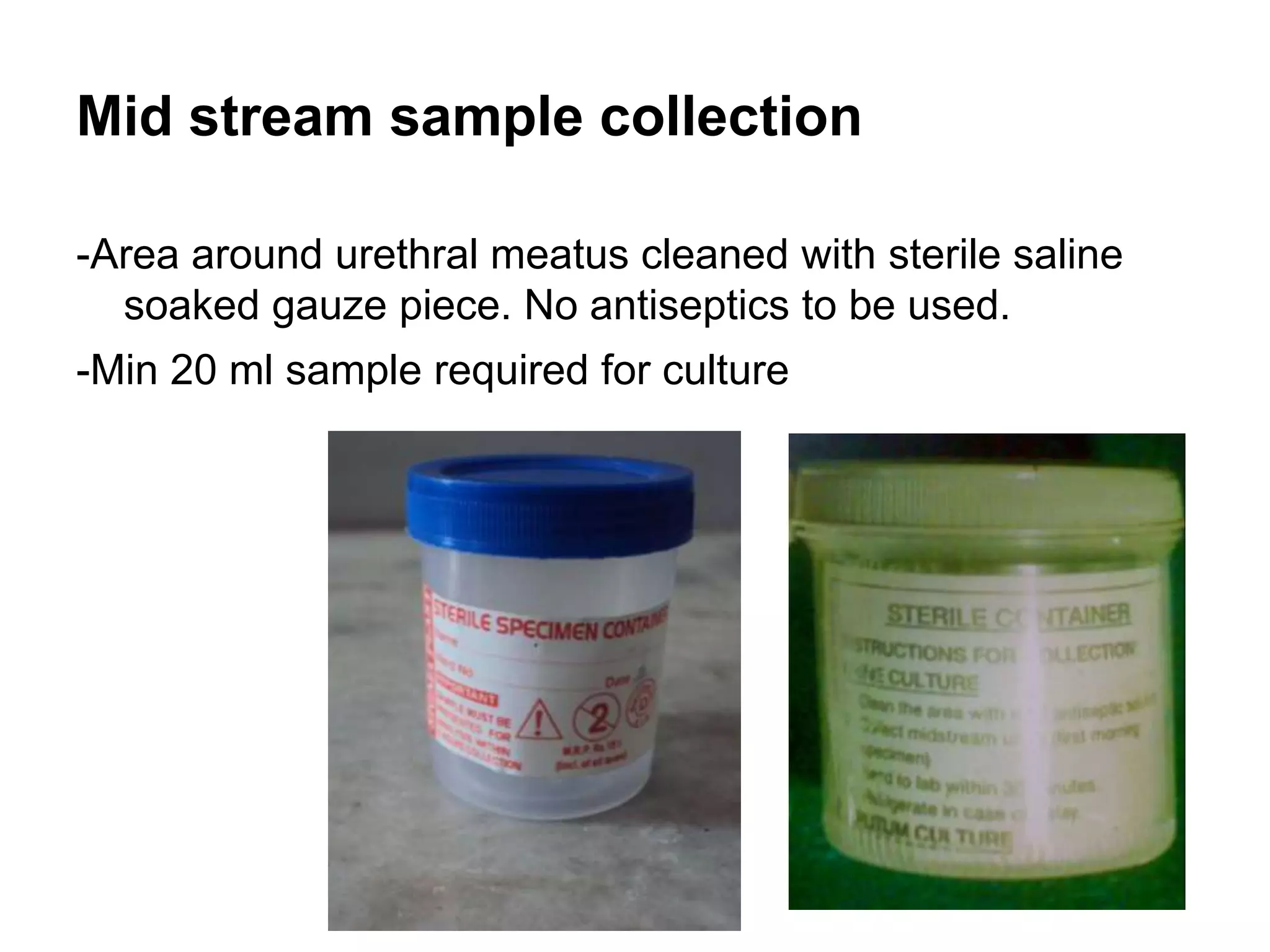 COLLECTION AND TRANSPORTATION OF CLINICAL SAMPLES | PPT