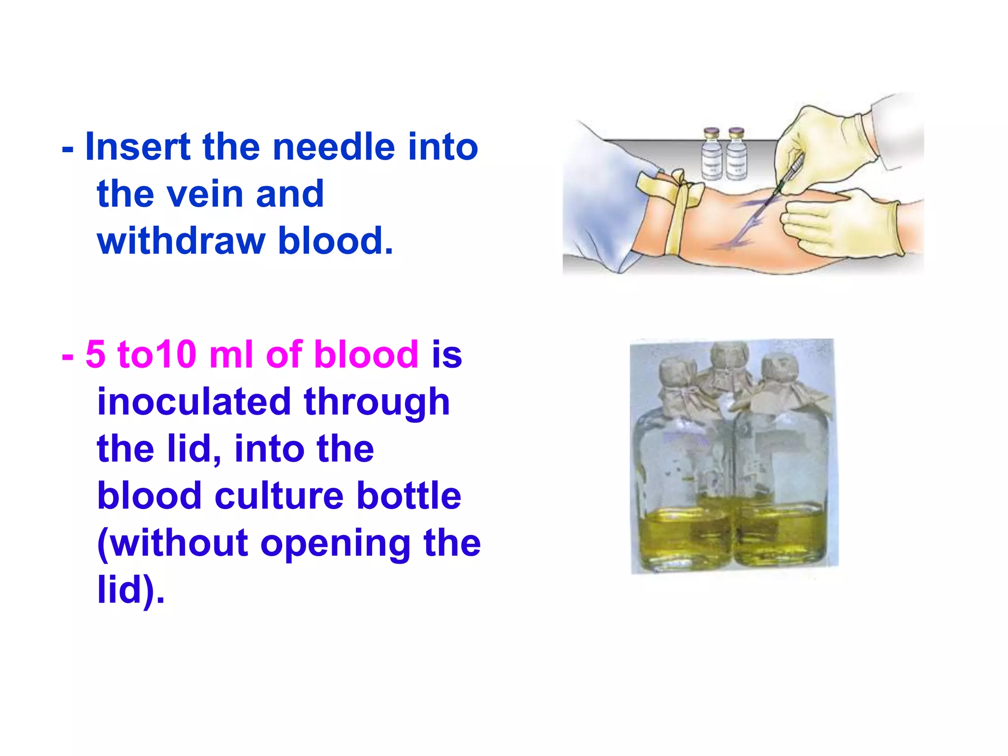 COLLECTION AND TRANSPORTATION OF CLINICAL SAMPLES | PPT