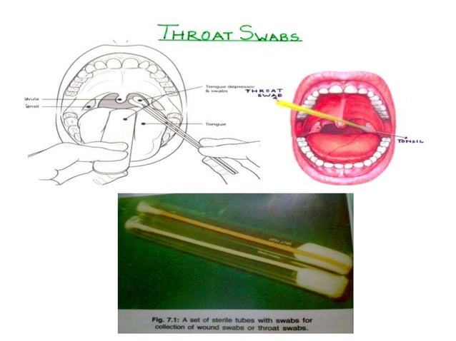 COLLECTION AND TRANSPORTATION OF CLINICAL SAMPLES | PPT | Ear, Nose and ...