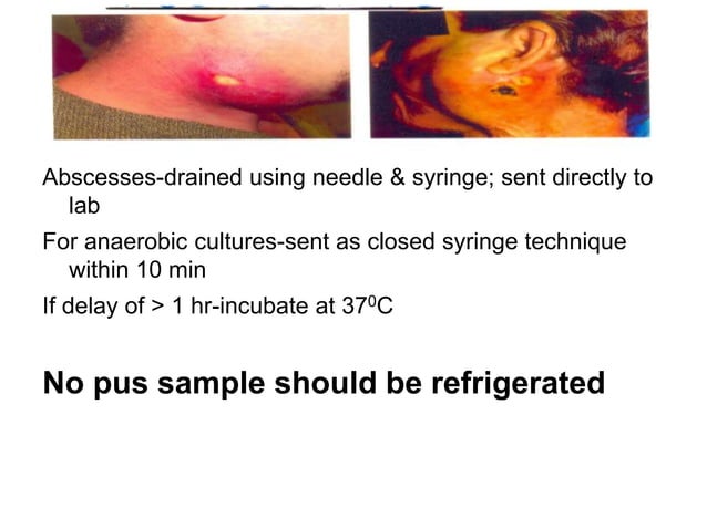 COLLECTION AND TRANSPORTATION OF CLINICAL SAMPLES | PPT | Ear, Nose and ...