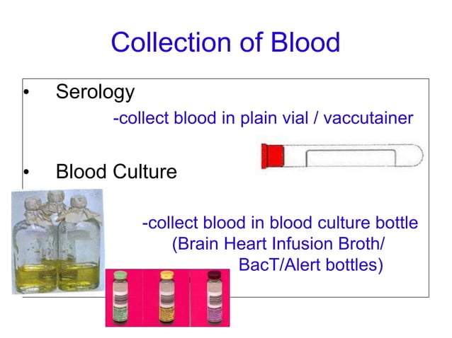 COLLECTION AND TRANSPORTATION OF CLINICAL SAMPLES | PPT | Ear, Nose and ...