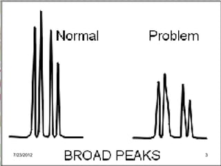 Vandeemeter equation | PPTX