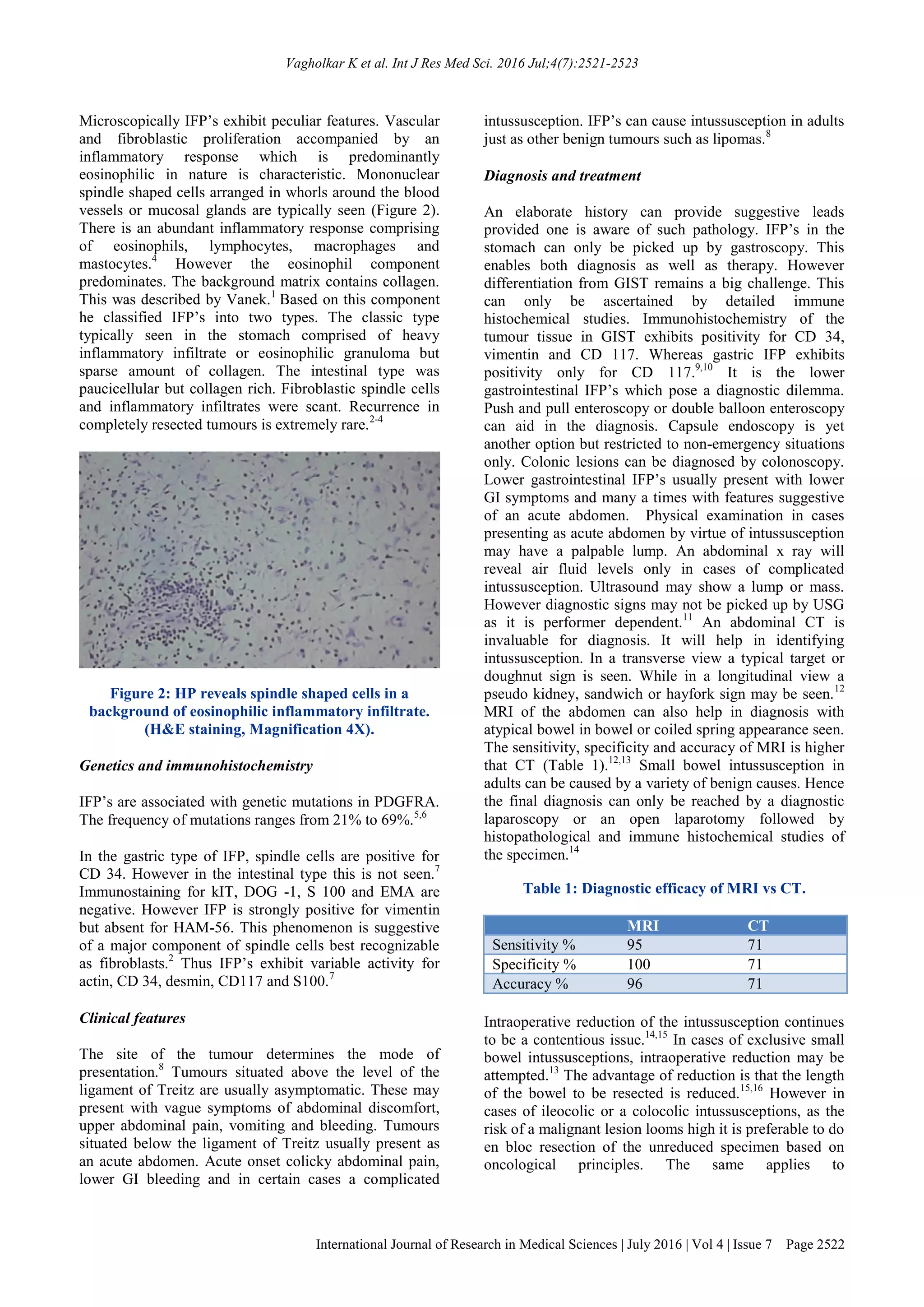 Inflammatory fibroid polyp (Vanek’s tumour) of the bowel | PDF