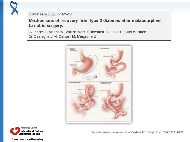 Targeting abdominal obesity in diabetology: What can we do about it?