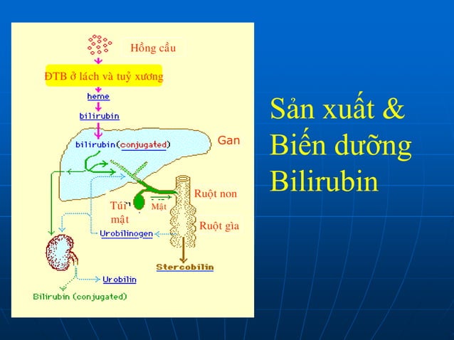 VÀNG DA TĂNG BILIRUBIN GIÁN TIẾP Ở TRẺ SƠ SINH | PDF