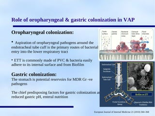 Ventilator Associated Pneumonia (VAP) causes and preventive strategies ...