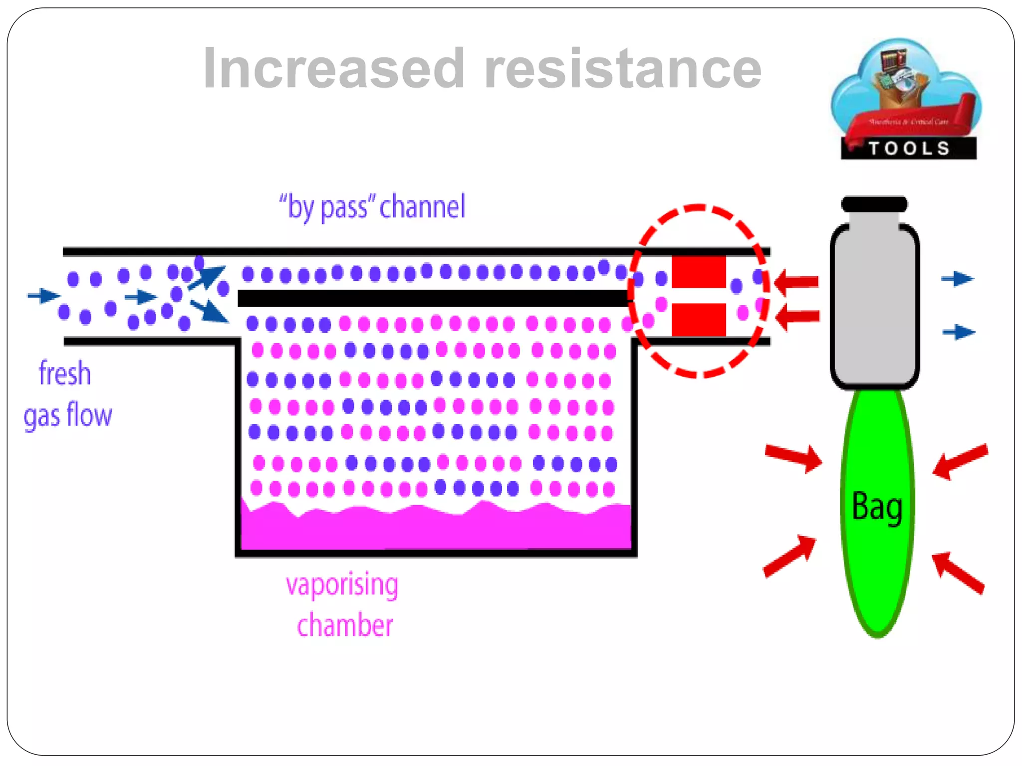 Understanding Anesthesia Vaporizers | PPSX