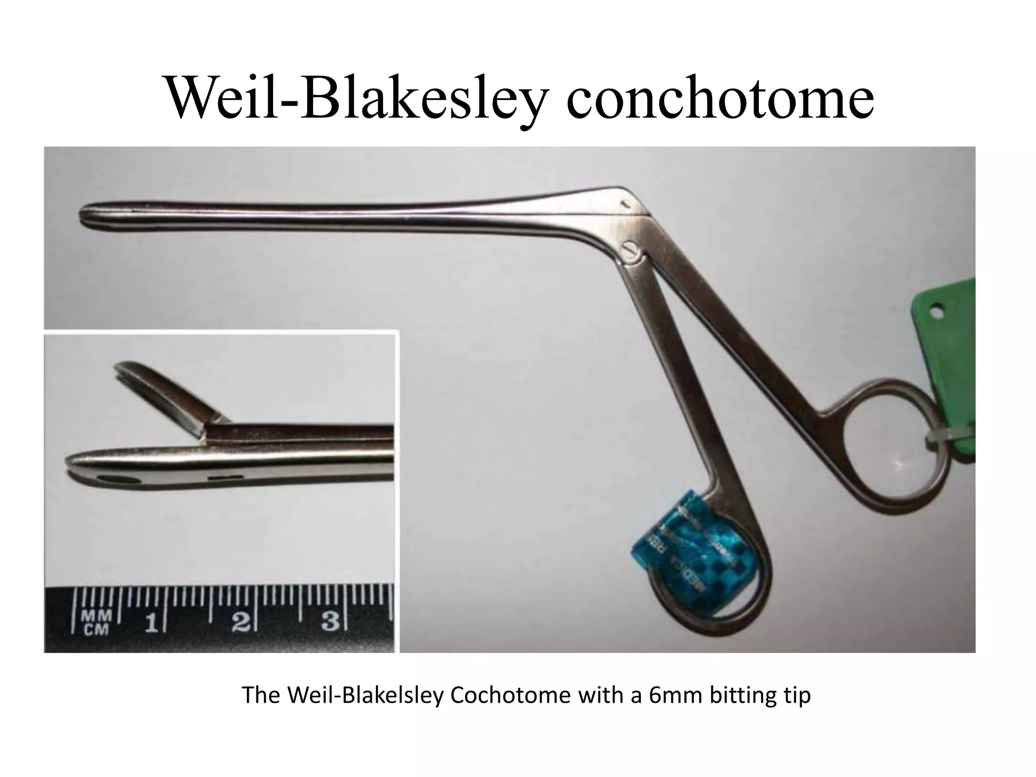 Muscle biopsy | PPTX