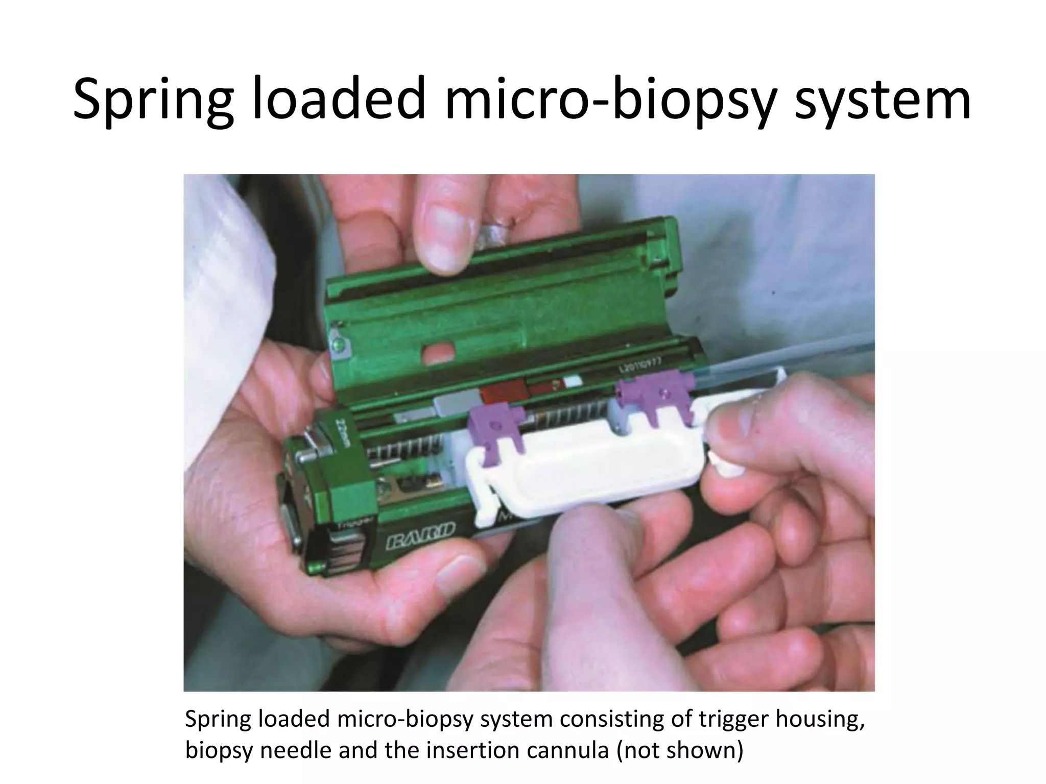 Muscle biopsy | PPTX