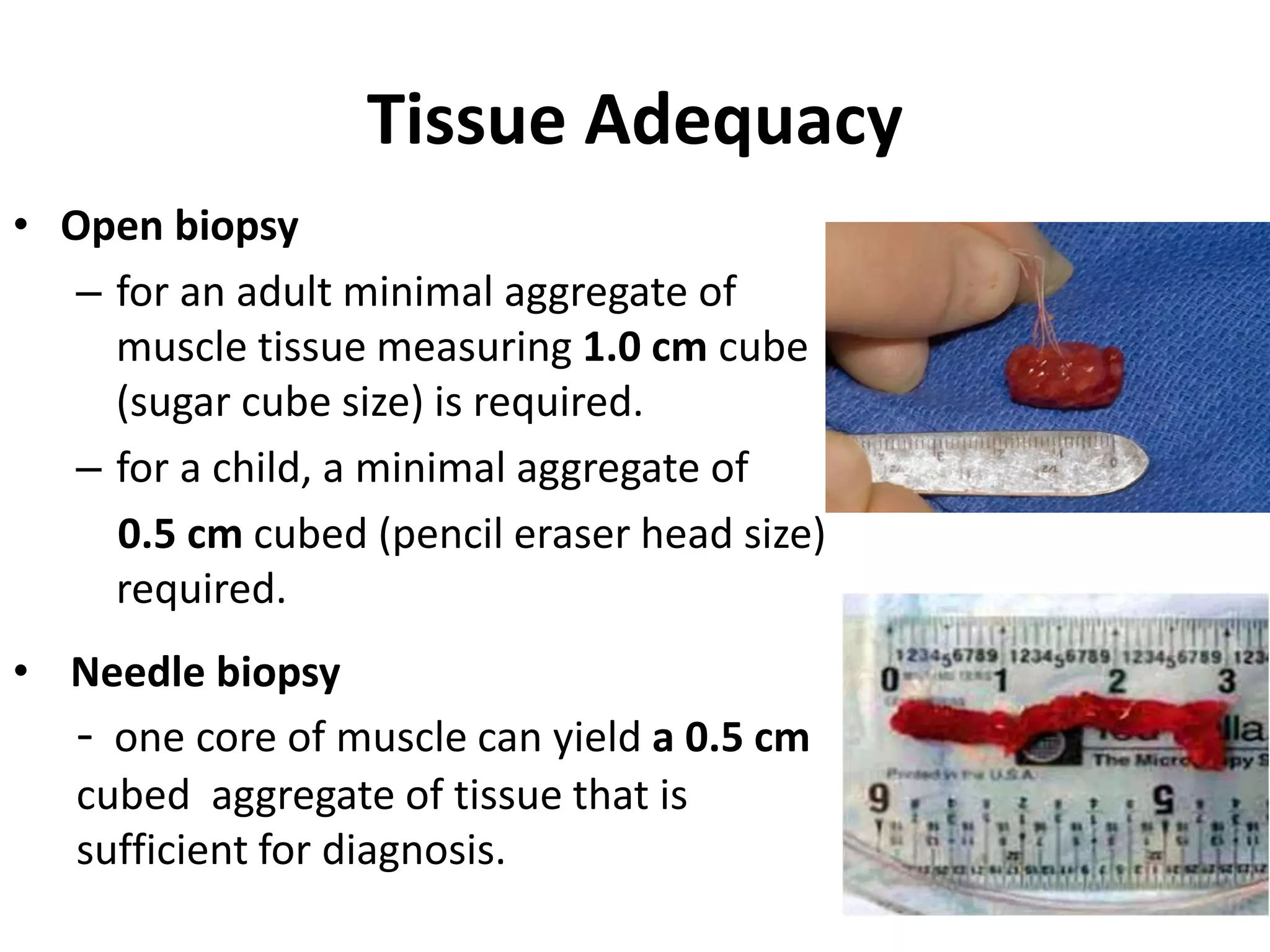 Muscle biopsy | PPTX