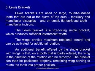 Vari simplex /fixed orthodontic courses /certified fixed orthodontic ...