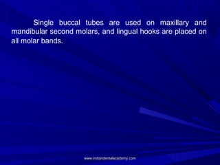 Vari simplex /fixed orthodontic courses /certified fixed orthodontic ...