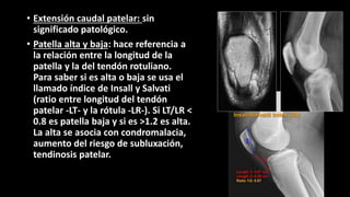 Variantes de rodilla y pie | PPTX