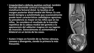 Variantes de rodilla y pie | PPTX