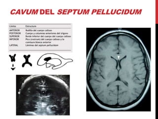 Variantes anatómicas del septum pellucidum | PPTX