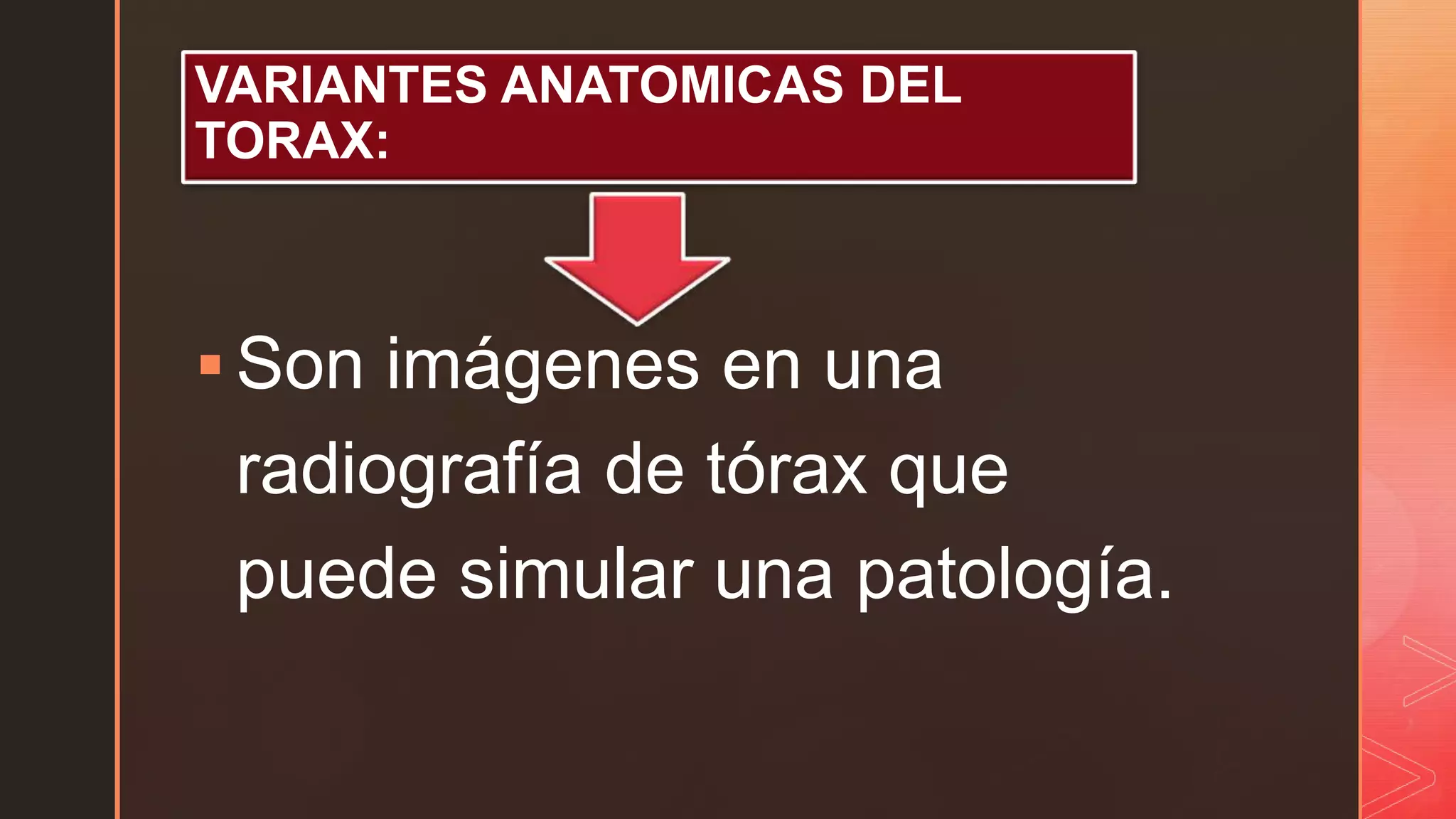 VARIANTES ANATOMICAS DEL TORAX | PPT
