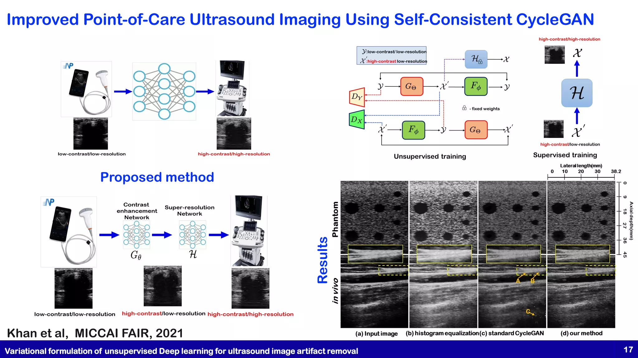 Variational Formulation Of Unsupervised Deep Learning For Ultrasound