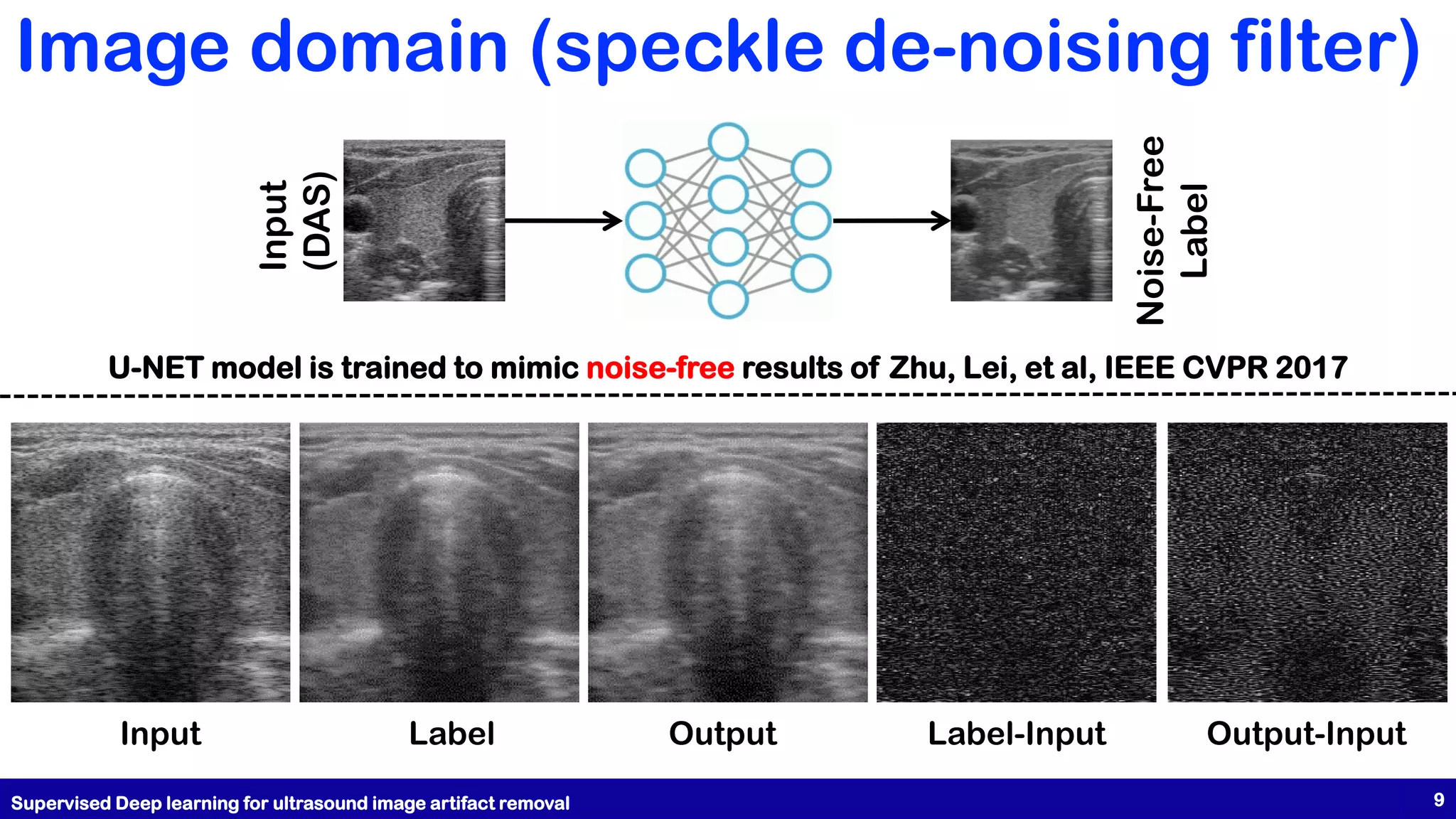 Variational Formulation Of Unsupervised Deep Learning For Ultrasound Image Artifact Removal Ppt