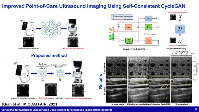 Variational Formulation Of Unsupervised Deep Learning For Ultrasound Image Artifact Removal Ppt
