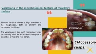 Variation in maxillary molars | PPTX