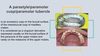 Variation in maxillary molars | PPTX
