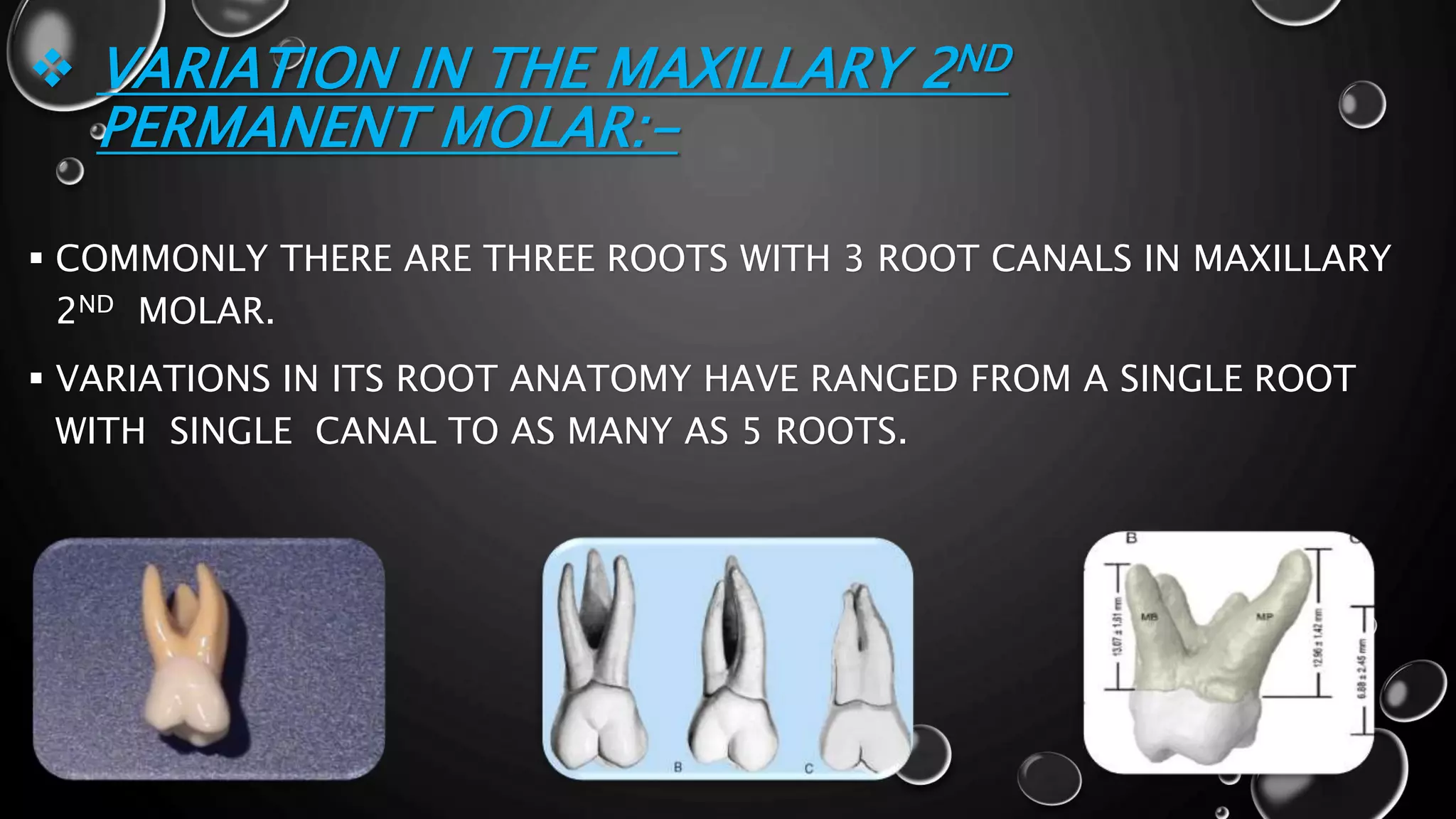 Variation in maxillary molars | PPTX