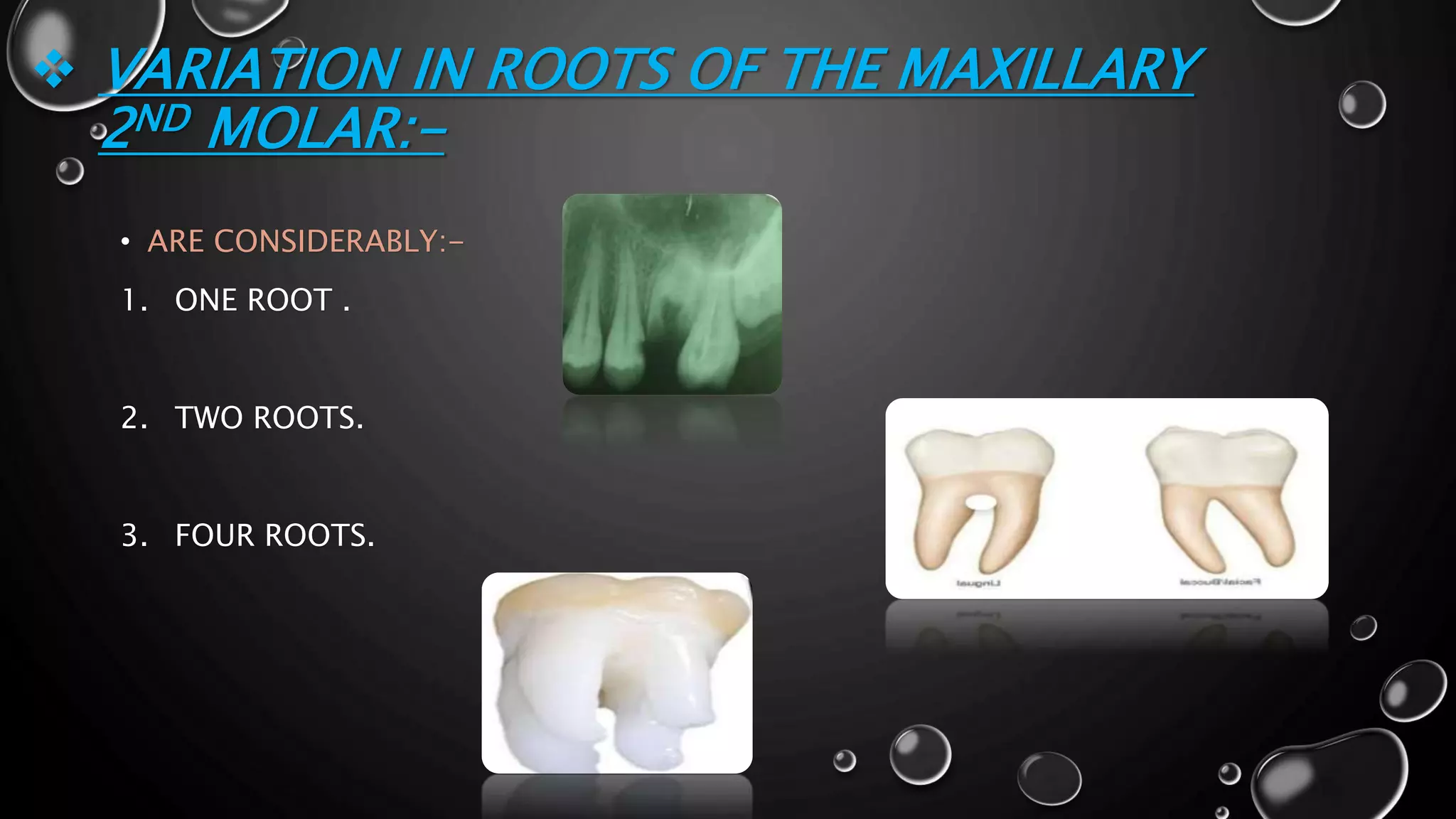 Variation in maxillary molars | PPTX