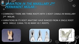 Variation in maxillary molars | PPTX
