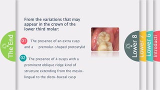 Variation of mandibular molars | PPTX | Dental Health | Diseases and ...