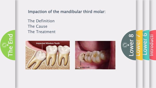 Variation of mandibular molars | PPT