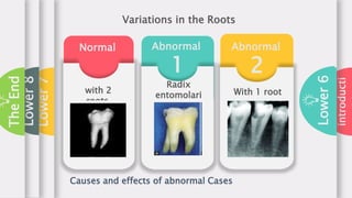 Variation of mandibular molars | PPTX | Dental Health | Diseases and ...