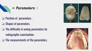 Variation of upper permanent molars | PPTX | Dental Health | Diseases ...
