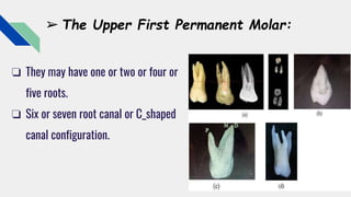 Variation of upper permanent molars | PPTX | Dental Health | Diseases ...