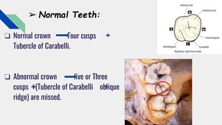 Variation of upper permanent molars | PPTX | Dental Health | Diseases ...