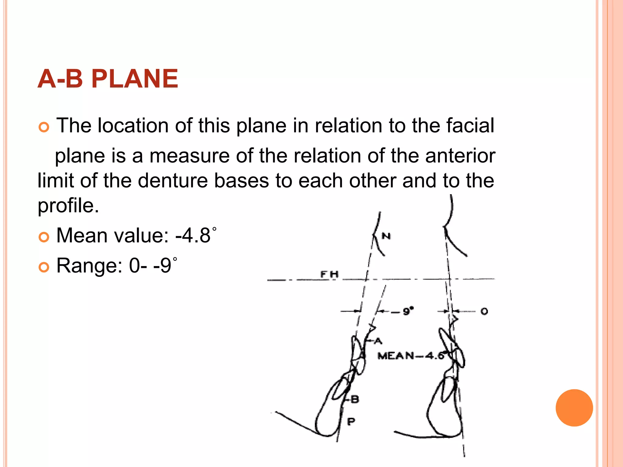 Downs analysis original article | PPTX